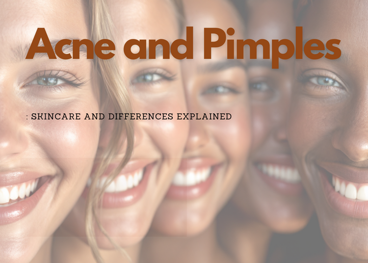 Acne vs. Pimples: Understanding the Differences and Effective Skincare ...